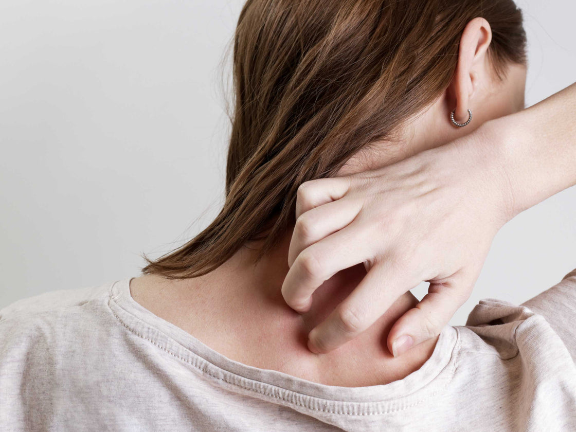 The Difference Between Eczema, Psoriasis & Dermatitis – esmi Skin Minerals