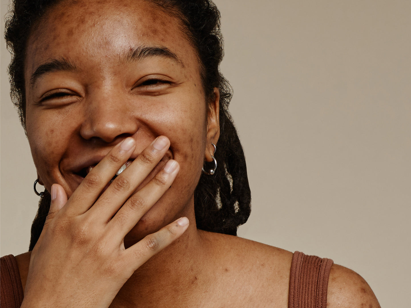 Tackling Hormonal Pigmentation: Your Guide to Brighter Skin – esmi Skin ...